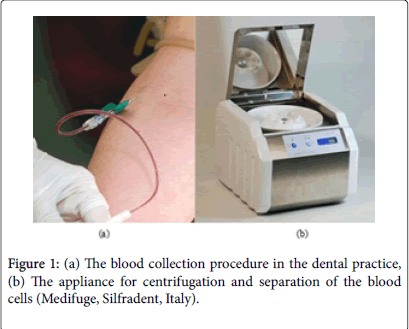 "IPG" DET Minimal Invasive Sinus Implant Placement and Grafting w