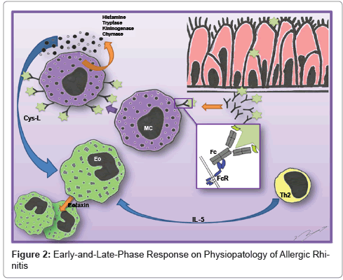 Allergic Rhinitis