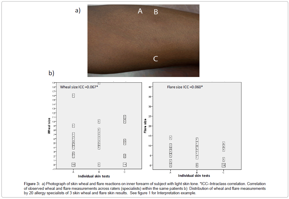 Variability in Measurement of Allergen Skin Testing Results among