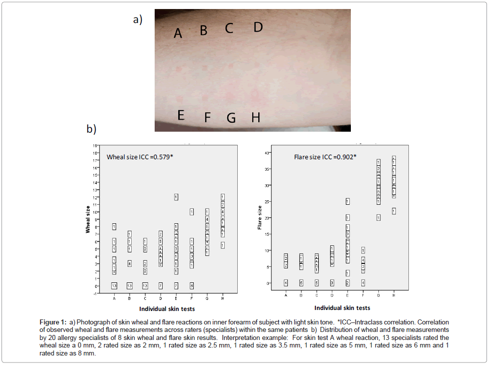 Variability in Measurement of Allergen Skin Testing Results among