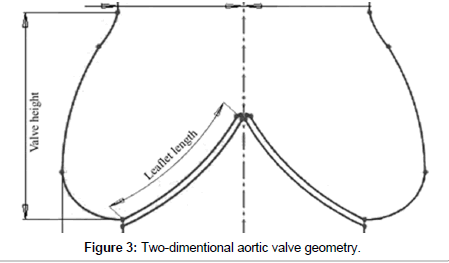 Applied Fluid-Structure Interaction Technique to Initial Insight into ...