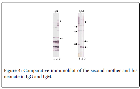 Assessment of Immunoblot for Early Detection of Seroconversion in