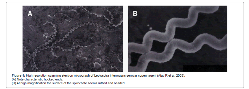 LEPTOSPIRA: Morphology, Classification and Pathogenesis