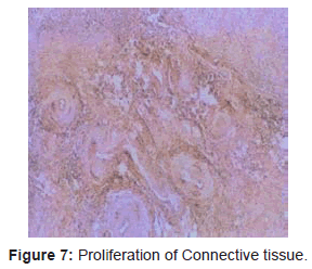Histopathological Study of Haemonchus contortus in Herrik Sheep A