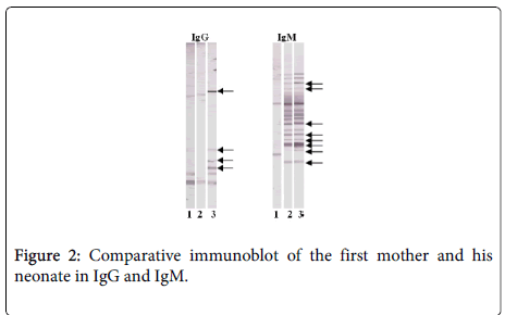Assessment of Immunoblot for Early Detection of Seroconversion in