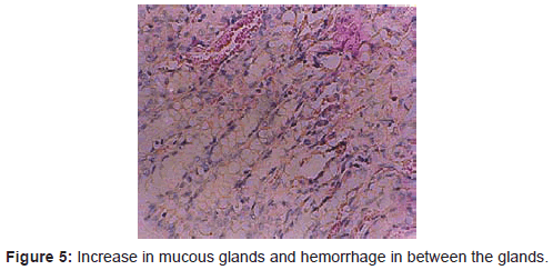 Histopathological Study of Haemonchus contortus in Herrik Sheep A