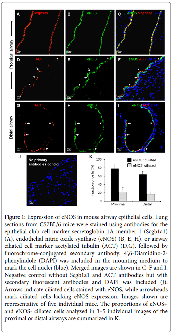 Evidence of Two Ciliated Epithelial Cell Subsets in Mouse Airways
