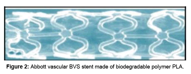 A Review on Biodegradable and Bioabsorbable Stents for Coronary A