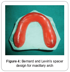 A Clinical Review of Spacer Design for Conventional Complete Denture
