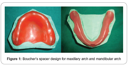 A Clinical Review of Spacer Design for Conventional Complete Denture