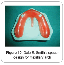 A Clinical Review of Spacer Design for Conventional Complete Denture