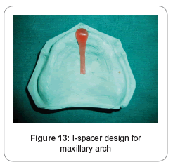 A Clinical Review of Spacer Design for Conventional Complete Dent