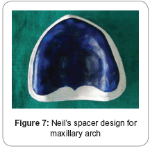 A Clinical Review of Spacer Design for Conventional Complete Denture
