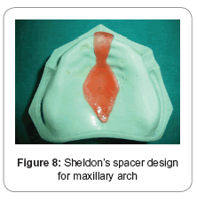 A Clinical Review of Spacer Design for Conventional Complete Denture