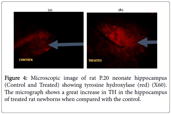 Inhibition of Dopamine Receptor in Neonate Hippocampus: Immunoloc