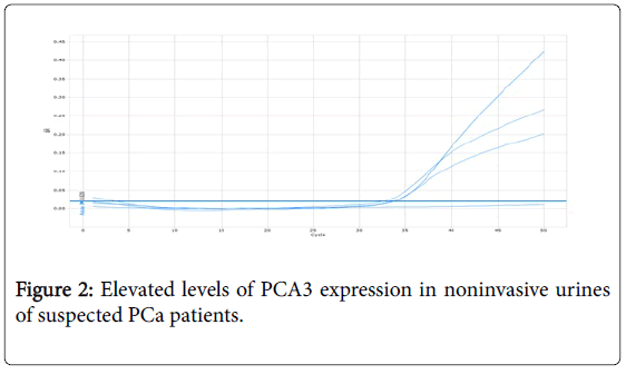 Investigation of Noninvasive Urine Specimens with Molecular Fluct