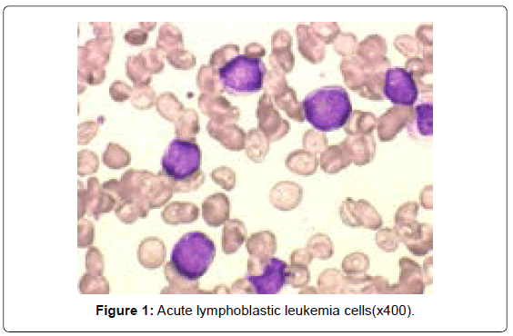 Double Lineage Switch from Acute Megakaryoblastic Leukemia (AML-M