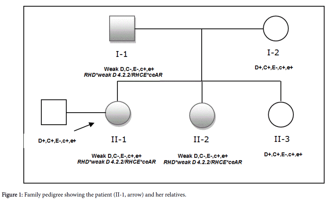 Management of Blood Transfusion in a Patient Carring Anti-Rh18 As