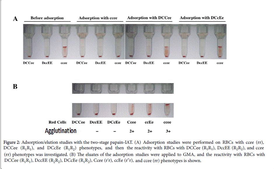 Successful Identification of Anti-f Alloantibody in a Non-transfused ...