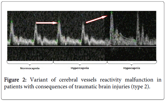 Identification of Disturbances of Autoregulation of Cerebral Hemo