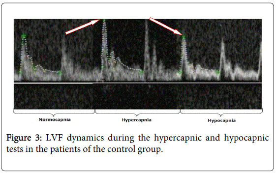 Identification of Disturbances of Autoregulation of Cerebral Hemo