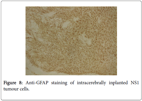 A GFP Positive Glioblastoma Cell Line NS1 A New Tool for Experime