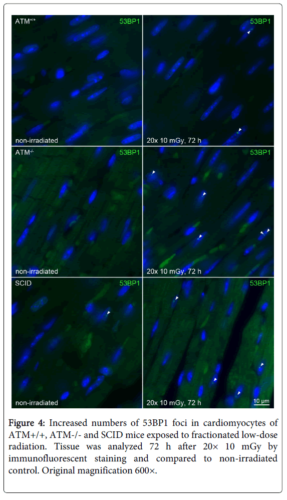 Genetically-Defined DNA Repair Capacity Determines the Extent of DNA ...