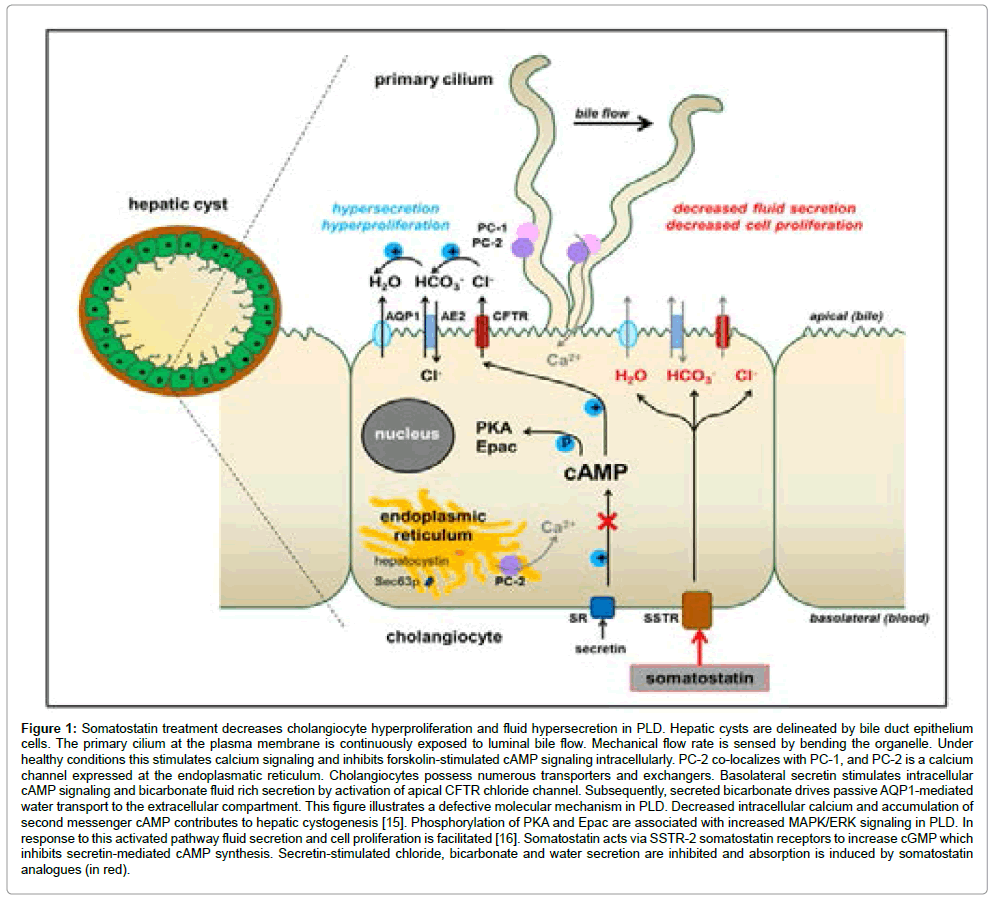Somatic Hits in Polycystic Liver Diseases
