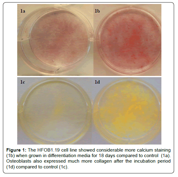 Mature Bone-Producing Osteoblasts Alter Gene Expression of Metastasis ...