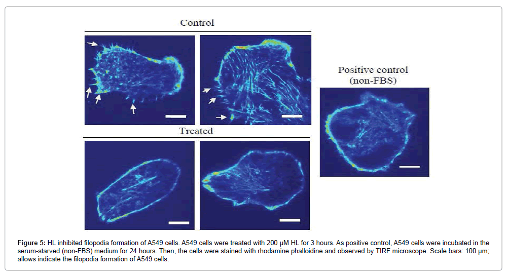 Cell Cycle Arrest by Hybrid Liposomes for Human Lung Carcinoma Cells