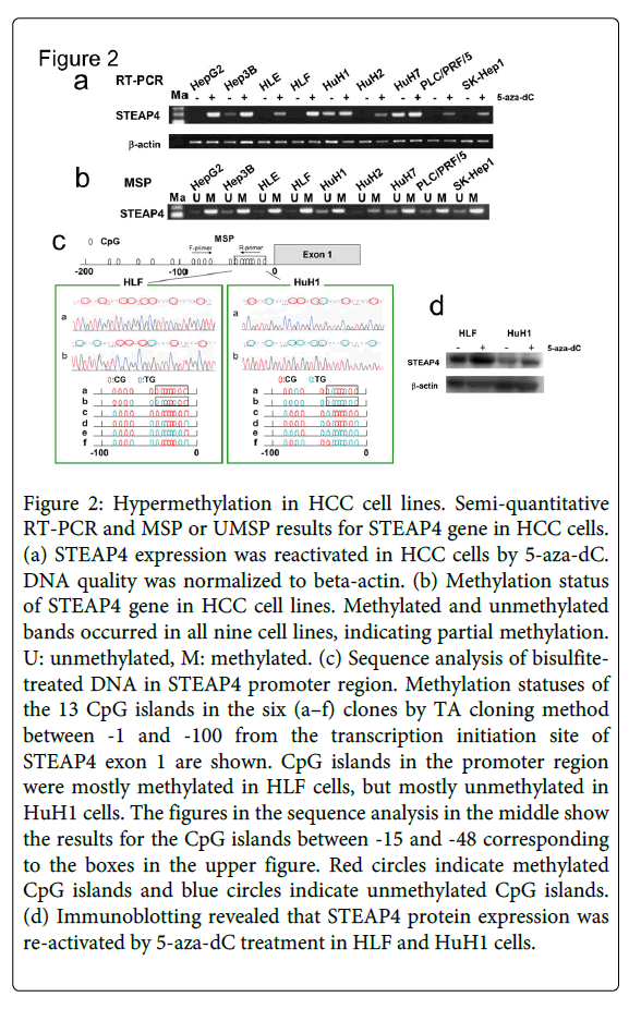 STEAP4 Inactivation Correlates Poor Prognosis and might be a Possible ...