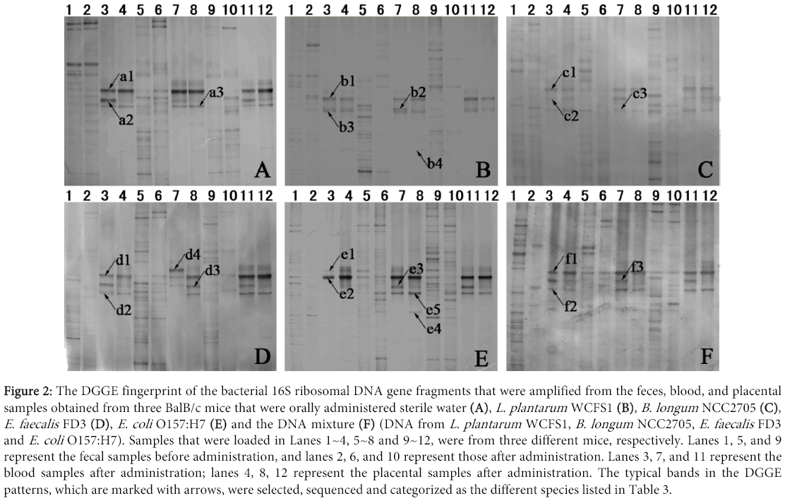 Comparison of Bacterial Composition in Blood and Placentas Using