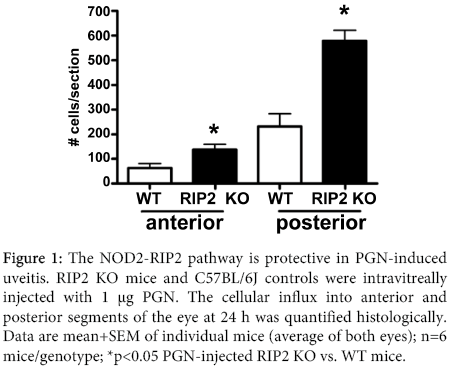 Molecular Signaling and Ocular Inflammation: An Update on the NOD