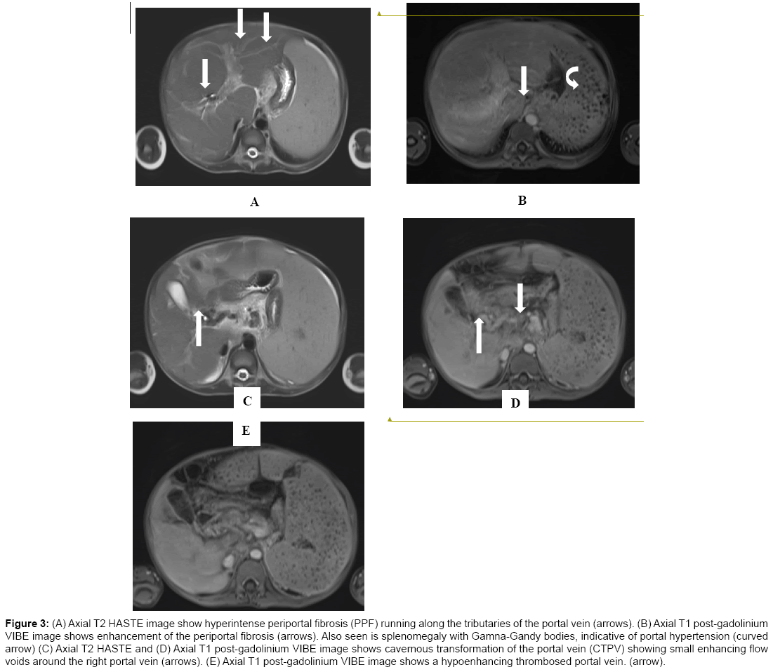 Utility of Diagnostic Imaging in the Diagnosis and Management of