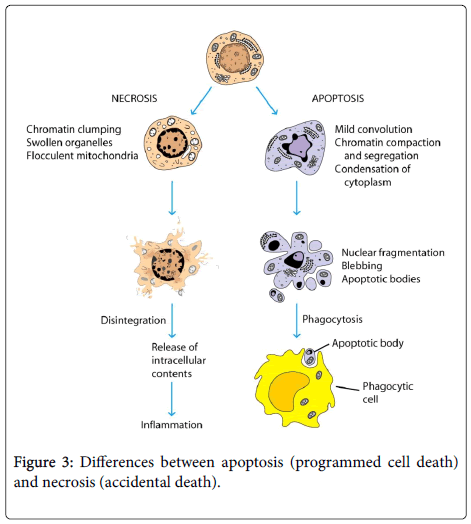 Role of Neutrophils Apoptosis in Osteomyelitis Pathogenesis