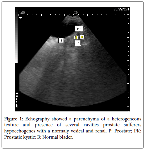 Chronic Prostatitis (CP) in Atlas Shepherd Dog: A Case-Control St