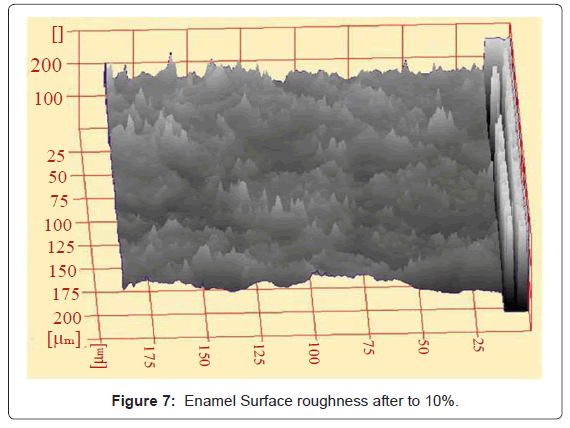 Effect of Three Bleaching Agent on Surface Roughness of Enamel (I