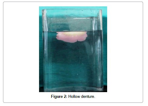 Cheek Plumper with a Salivary Reservoir: An Esthetic and Function