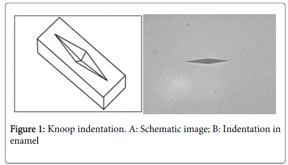 Methodologies to Analyze the Micromorphological Alterations of Enamel ...