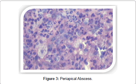 Relationship between Clinical and Histopathologic Findings of 40 ...