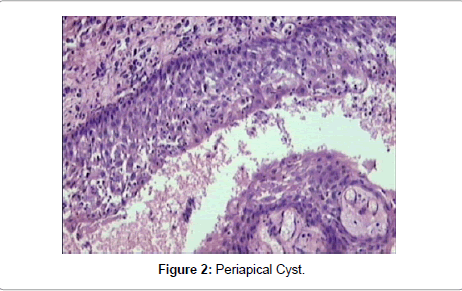 Relationship between Clinical and Histopathologic Findings of 40 ...
