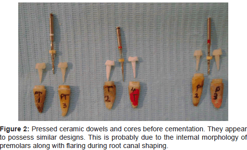 Effect of Dowel Material and Design on the Fracture Resistance of