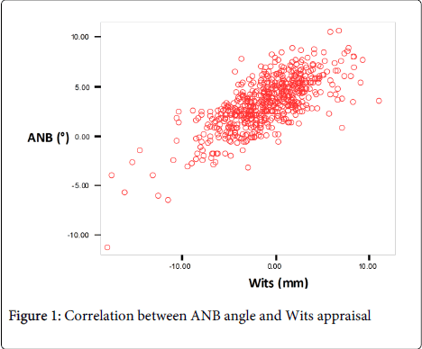 ANB, Wits And Molar Relationship, Do They Correlate In Orthodonti