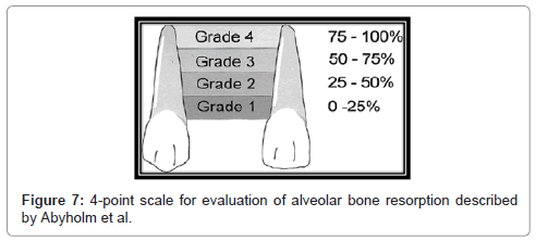 Efficacy of Platelet-Rich Plasma in Reduction of the Resorption of the ...