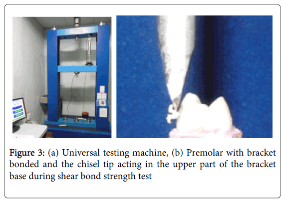Evaluation of Different Brands of Led Curing Devices for Bonding ...