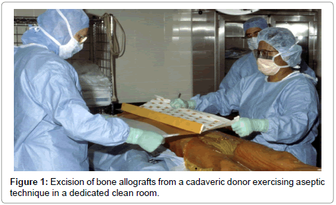 Bone Allografts In Dentistry: A Review