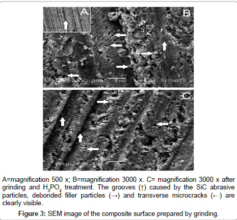 The Effect of Surface Treatment and Adhesive System on the Durability ...