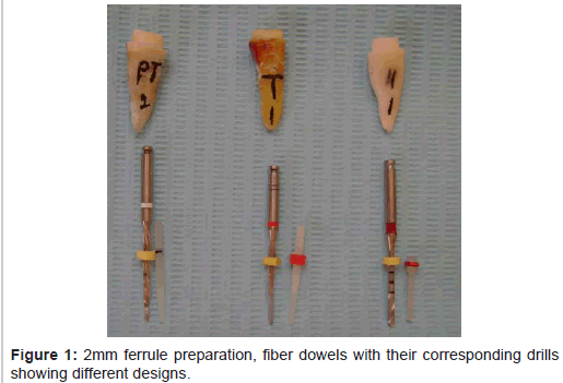 Effect of Dowel Material and Design on the Fracture Resistance of