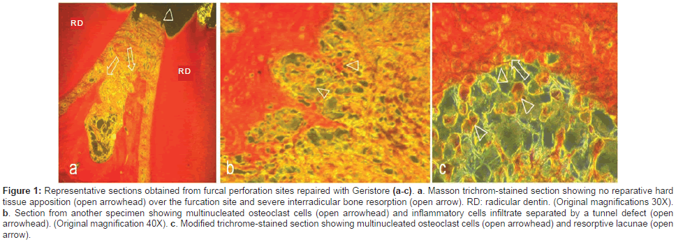 Histological Examination of Furcal Perforation Repair Using Geristore ...