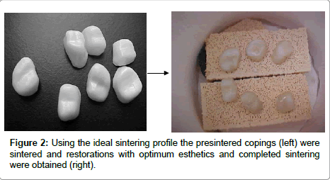 Microwave Sintering of Ceramics for Dentistry: Part 2